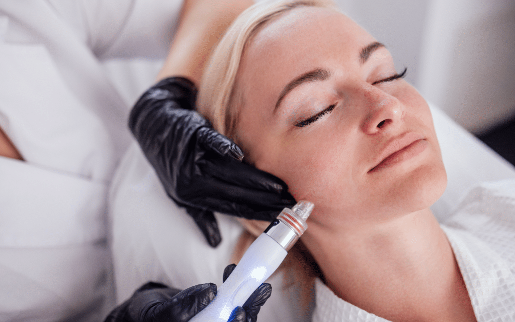 Bioestimuladores de Colágeno: tipos y beneficios | Dra. Lady Segovia